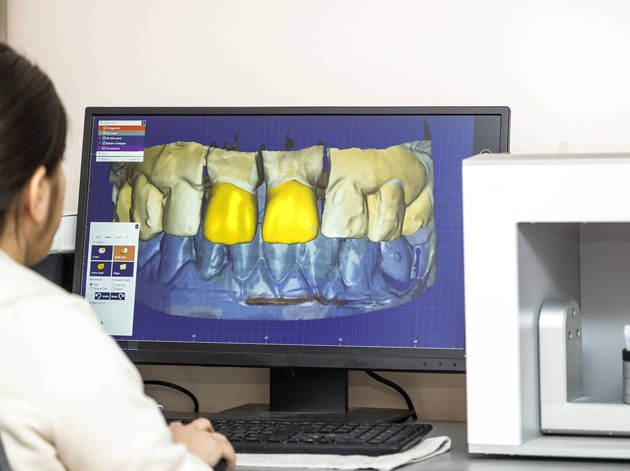 Digital Scanning Houston TX - Dentiq Dentistry