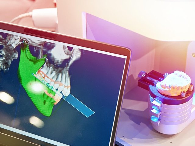 Digital Dentures Houston TX - Dentiq Dentistry