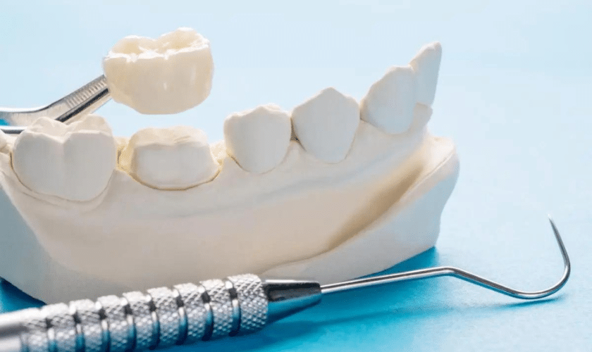 When Your Dental Crowns Break: 7 Steps to Take Immediately