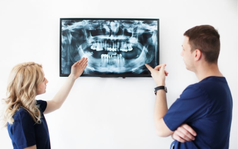 Types of Dental X-rays: Bitewing, Periapical, Panoramic